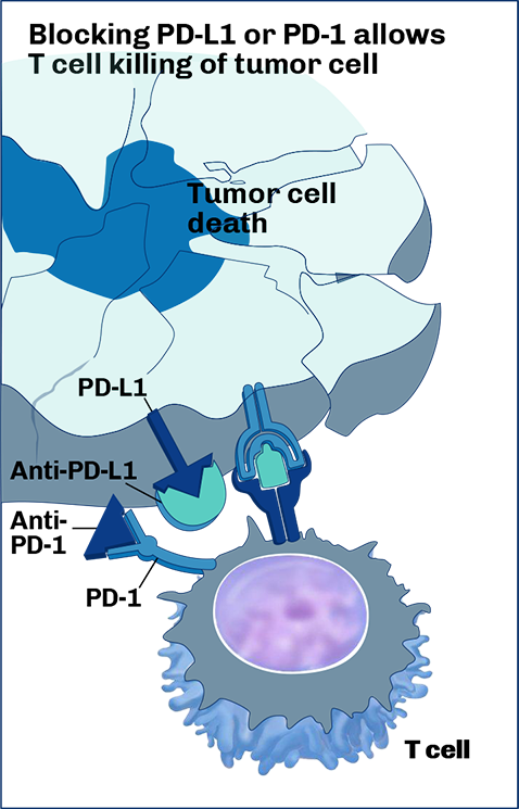 Predict checkpoint inhibitor benefit with new Immunotherapy Response ...